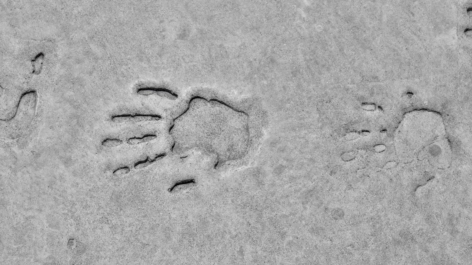 What Is Patellectomy: Overview, Benefits, And Expected Results - Adoctor