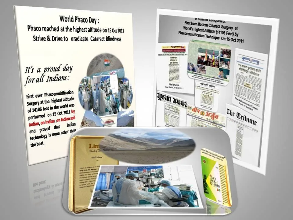 What Is Phacoemulsification Overview Benefits And Expected Results Adoctor